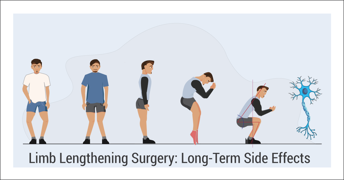 Limb Lengthening Surgery Long Term Side Effects Limb Lengthening Surgery Long Term Side Effects